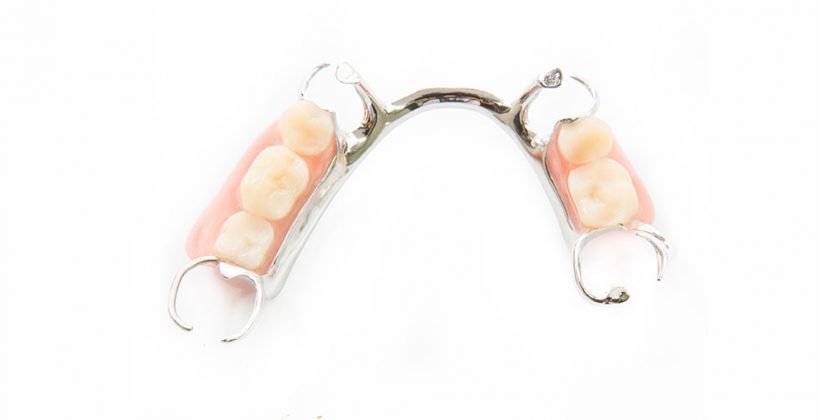 Kunstgebit of prothese - Tandarts EVI-DENT